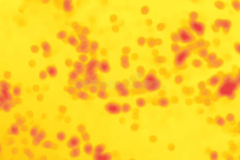 515 Yellow Blood Cell Stock Photos - Free & Royalty-Free Stock Photos ...