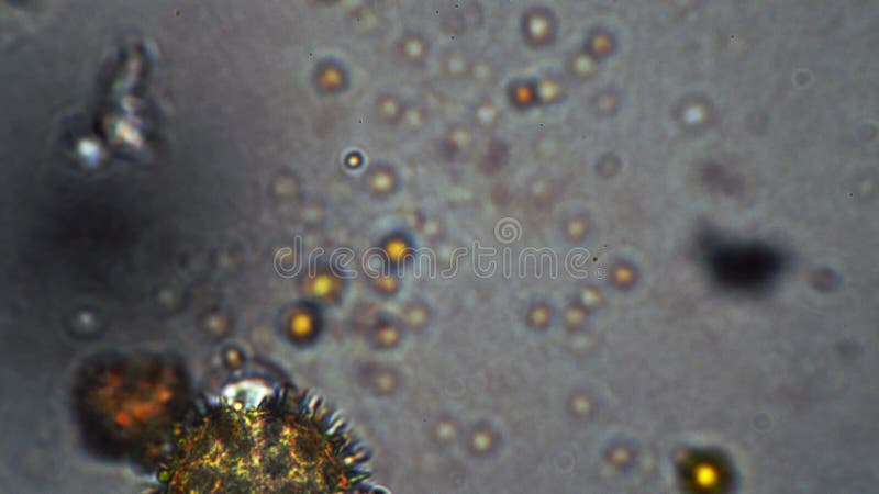 Microscopy of Allergic Agent Pollen Cell of the Foalfoot Looking Like ...