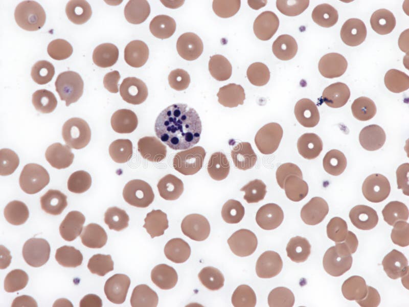 Cell Apoptosis Peripheral Blood Stock Photos - Free & Royalty-Free ...