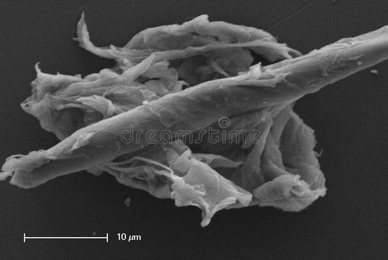 Cell Culture Contamination stock photo. Image of cells - 34441272 Cell Culture Contamination stock photo. Image of cells - 34441272