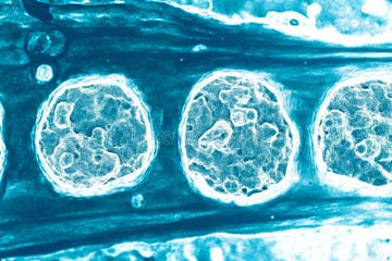 Cell Division in Human Body Under Microscope View Stock Illustration ...