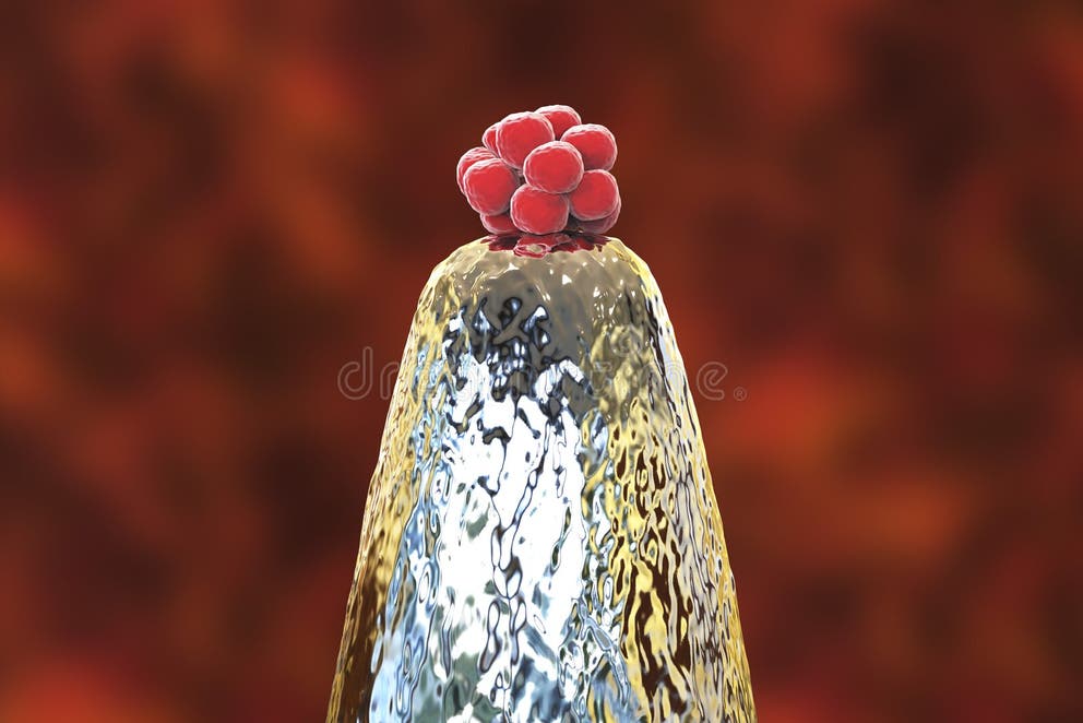 16-cell Human Embryo on a Needle Tip Stock Illustration - Illustration ...