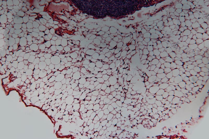 Cell lymph node dog stock photo. Image of infection, awareness - 98139684