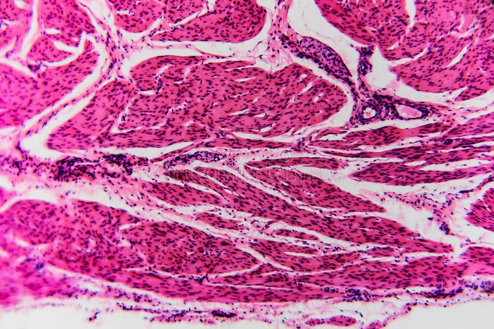 Cell Microscopic- Bladder of the Cat Stock Photo - Image of rectum ...