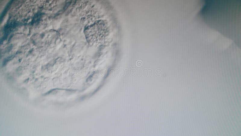 A Cell Moving Under a Microscope in Laboratory. Ivf, in Vitro ...