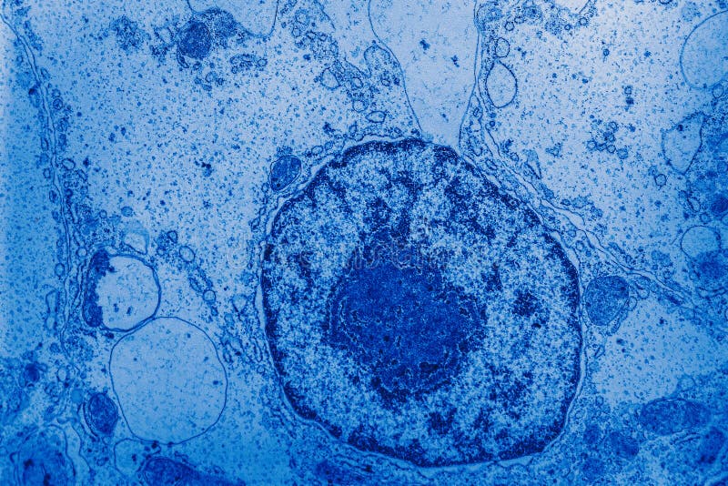 Cell nucleus. TEM stock photo. Image of electron, ultrastructure ...