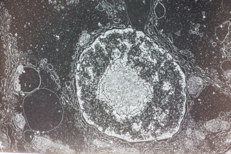 Cell Nucleus and Organelles Under the Electron Microscope Stock Photo ...