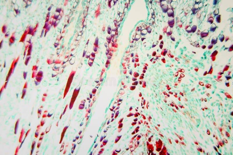 Cell Pinus Female Strobile LS Stock Image - Image of bacteria ...