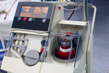 Cell Saver Device for Surgery Stock Photo - Image of close, laboratory ...