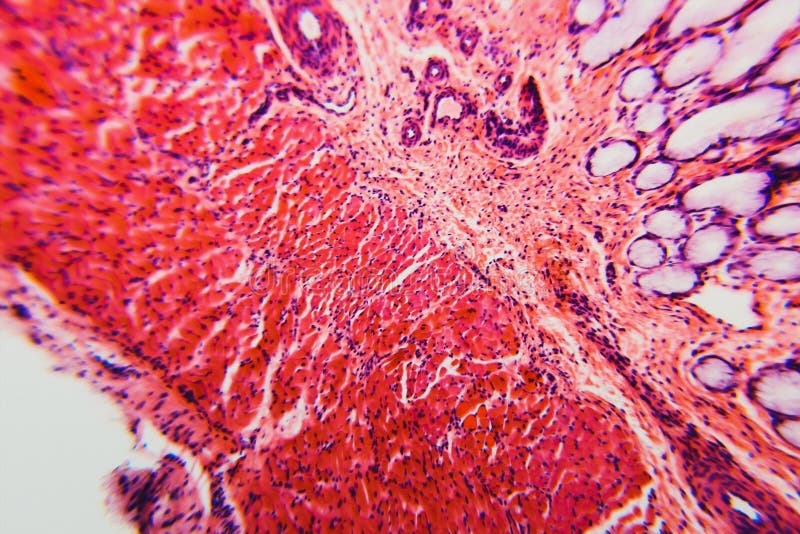 Cross Section Esophagus Dog Stock Image - Image of gastric, colon ...