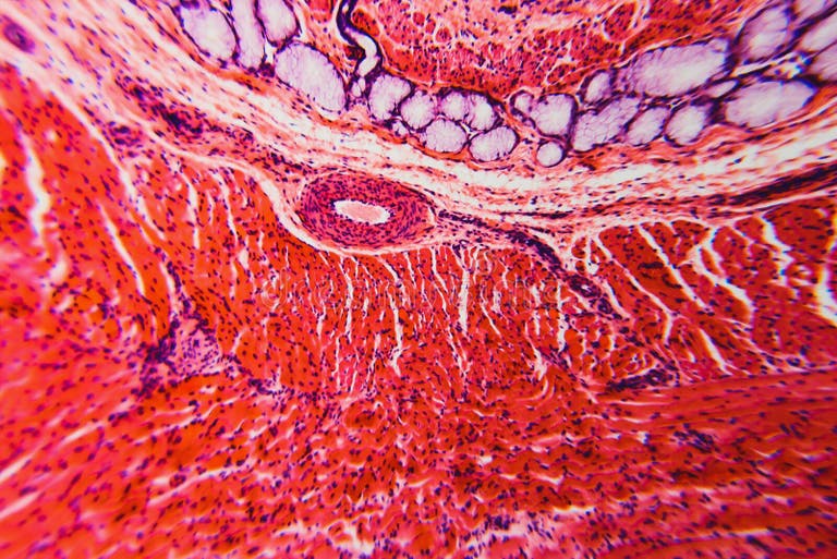 115 Colon Cross Section Stock Photos - Free & Royalty-Free Stock Photos ...