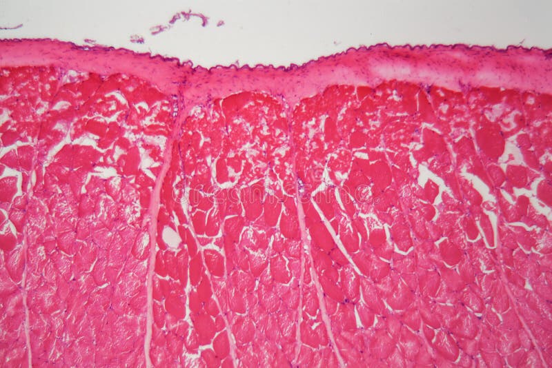 Fish Skin Injured by Chemicals Under the Microscope Stock Image - Image ...