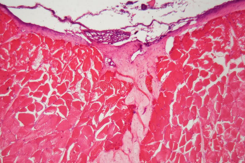 Fish Skin Injured by Chemicals Under the Microscope Stock Image - Image ...