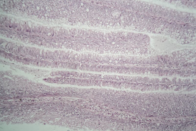 Cells of a Human Large Intestine Under the Microscope Stock Photo ...