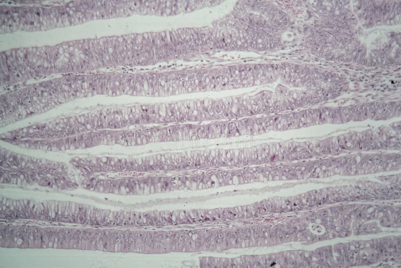 Cells of a Human Large Intestine Under the Microscope Stock Photo ...