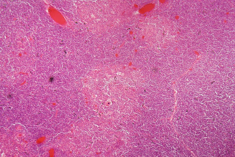 Cells of a Human Thymus Gland Under the Microscope Stock Photo - Image ...