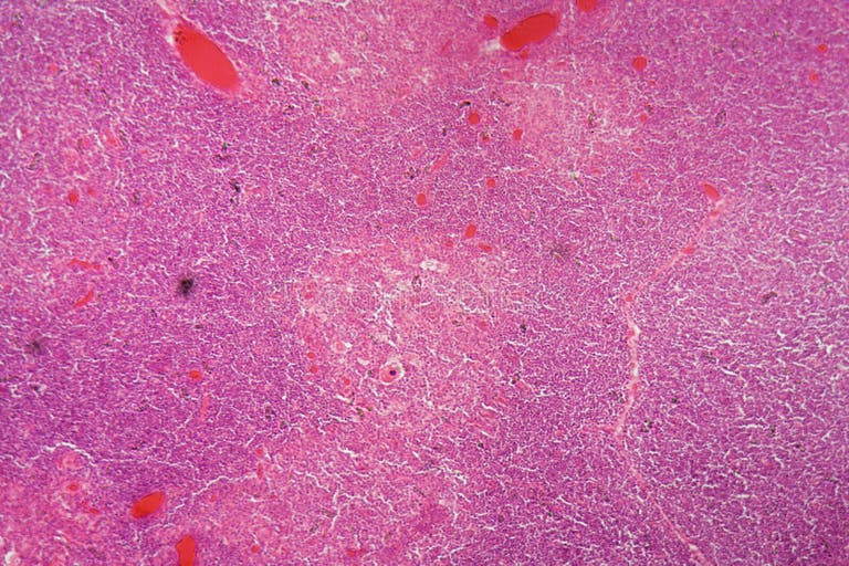 Cells of a Human Thymus Gland Under the Microscope Stock Photo - Image ...