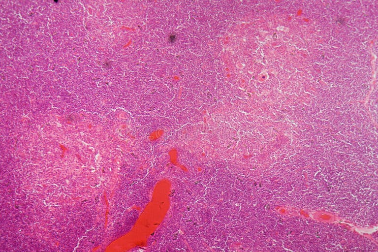 Cells of a Human Thymus Gland Under the Microscope Stock Image - Image ...