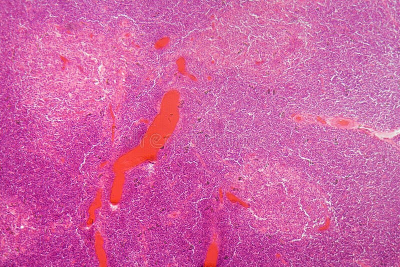 Cells of a Human Thymus Gland Under the Microscope Stock Photo - Image ...