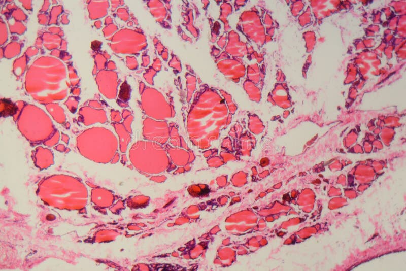Thyroid Gland Cells Under the Microscope Stock Image - Image of health ...