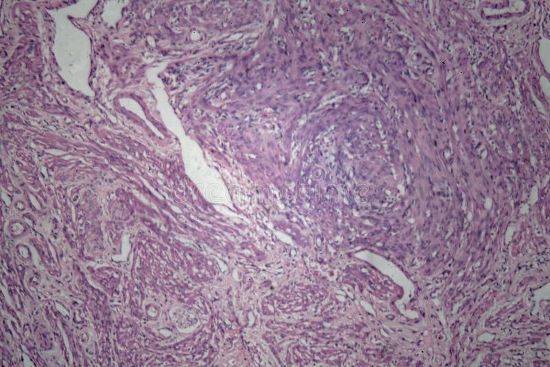 Histology of the Uterus stock photo. Image of mircoscopic - 49104002