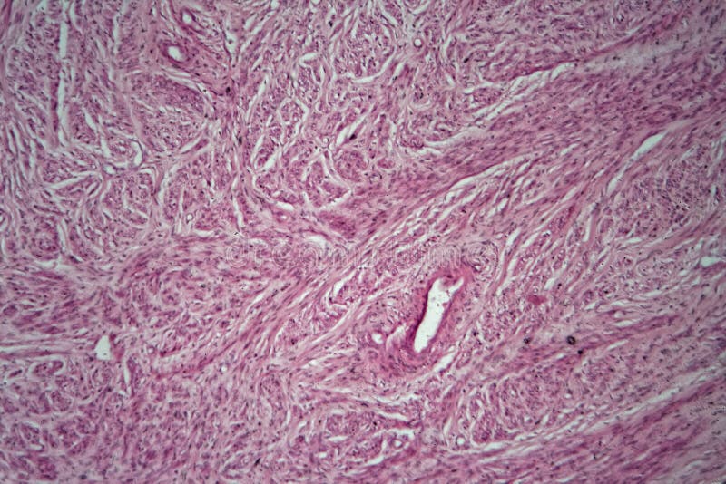 Histology of the Uterus stock photo. Image of mircoscopic - 49104002