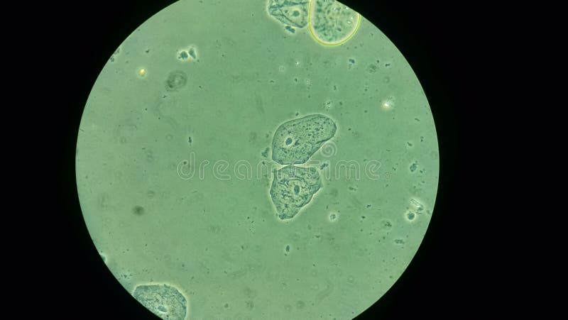 Cells on a Microscope stock image. Image of human, nucleo - 93452631