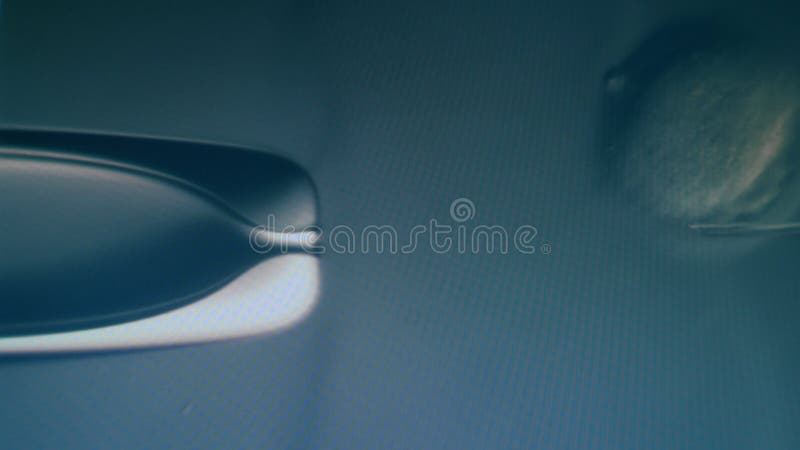 IVF, in Vitro Fertilisation Process Held in Lab. Liquid Substance is ...