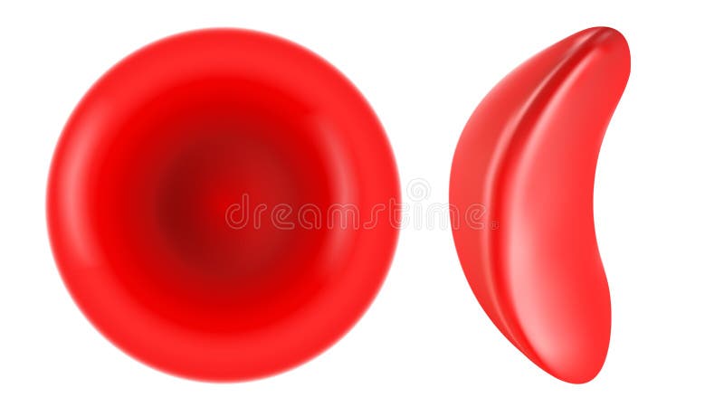 Cellula Falciforme Ed Illustrazione Normale Del Globulo Rosso ...
