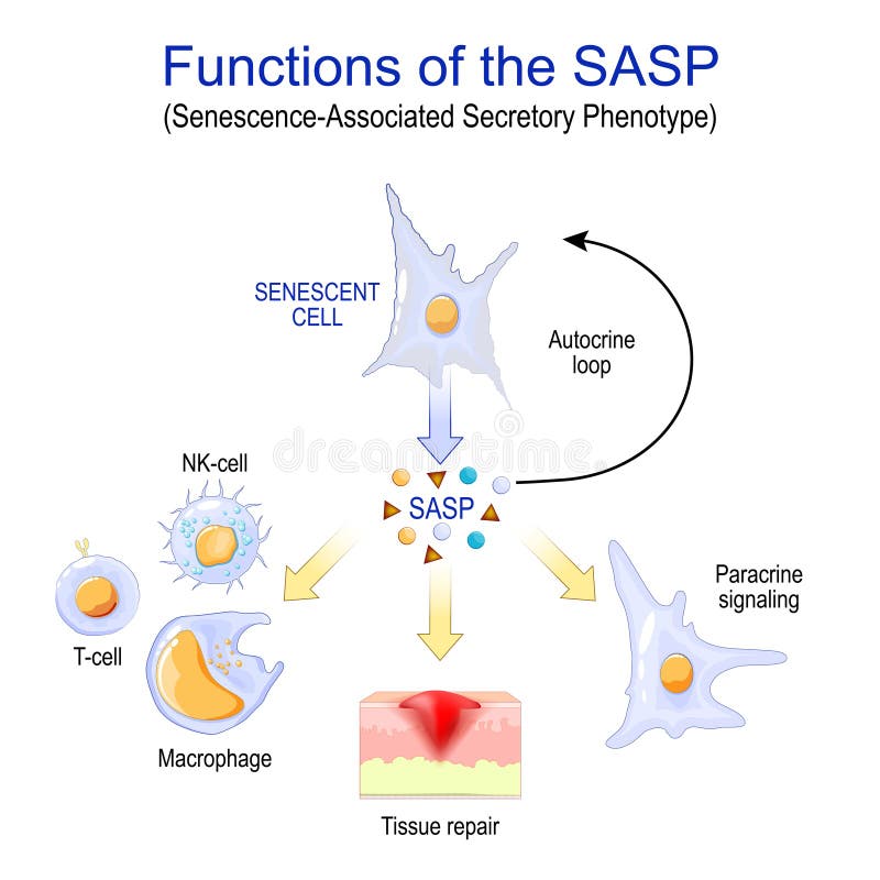 Sasp Stock Illustrations – 6 Sasp Stock Illustrations, Vectors ...