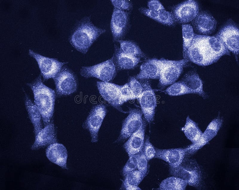 Cellules malades image stock. Image du chimique, affaiblissement - 16287345