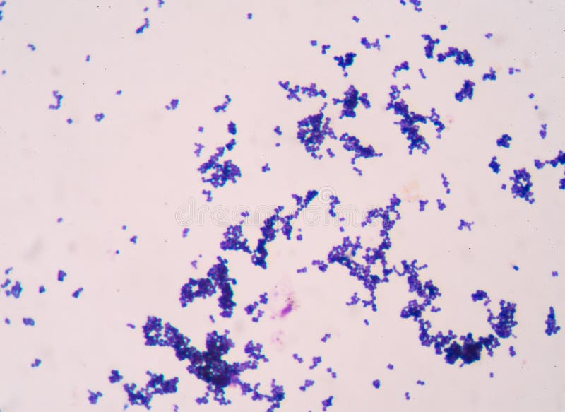 Coques à Gram Positif De Cellules De Bactéries Photo stock - Image du ...