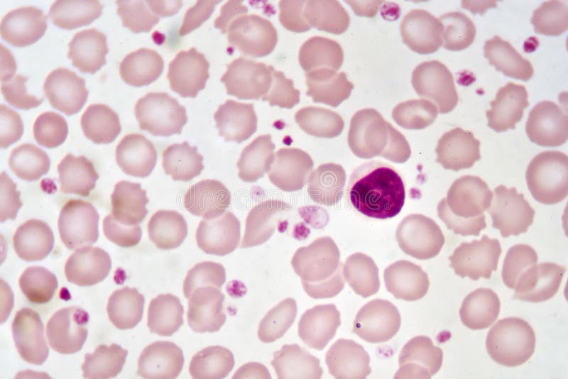 Cellule De Lymphocyte Dans La Calomnie De Sang Photo stock - Image du ...