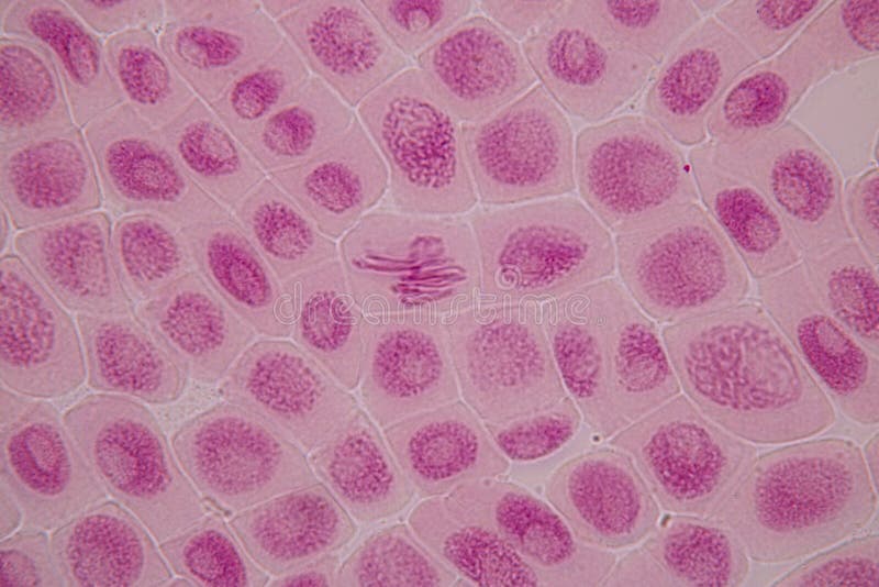 Cellule De Mitose Dans La Pointe De Racine De L'oignon Au Microscope ...