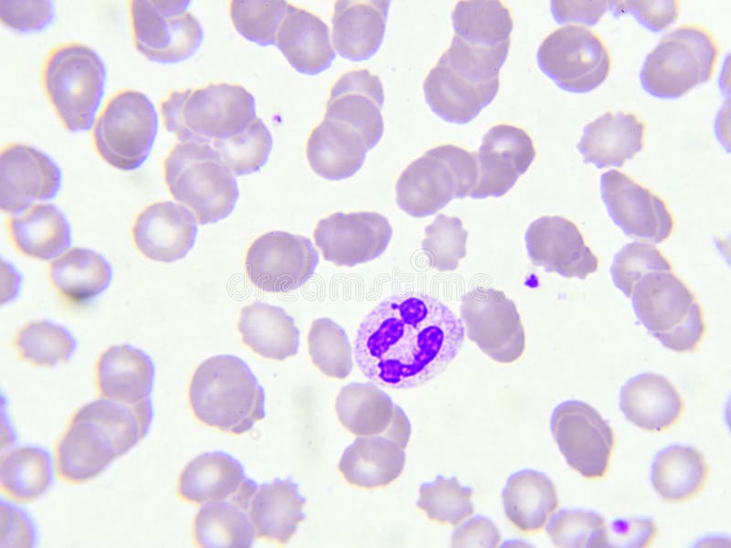 Cellule De Neutrophile Dans La Calomnie De Sang Image stock - Image du ...