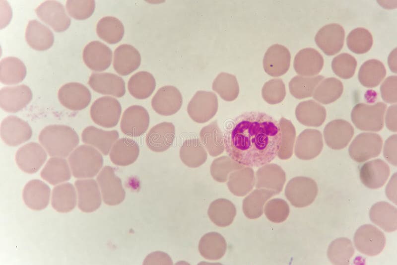 Cellule De Neutrophile Dans La Calomnie De Sang Image stock - Image du ...