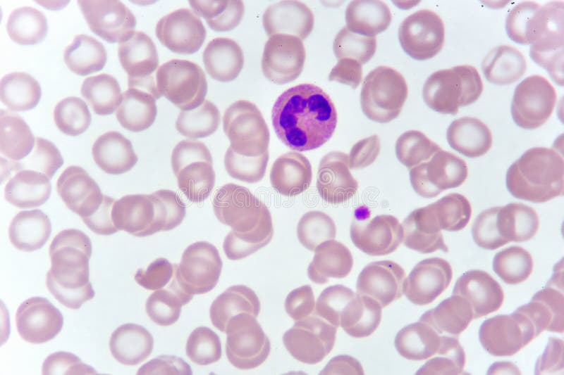Cellule De Neutrophile Dans La Calomnie De Sang Image stock - Image du ...