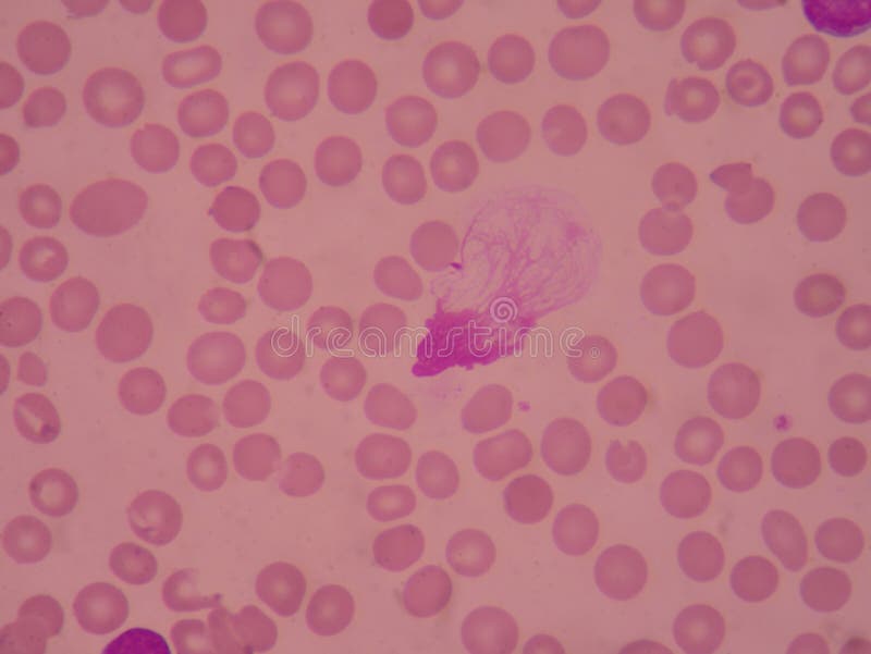 Cellule De Panier Sur Le Fond De Globules Rouges Image stock - Image du ...