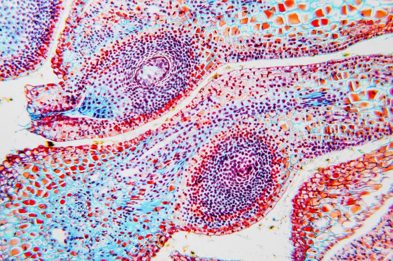 Histologie De Tissu Humain D'ovaire Image stock - Image du noyau ...