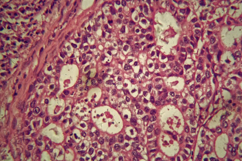 Tissu Nerveux Sous Un Microscope Image stock - Image du biologie ...