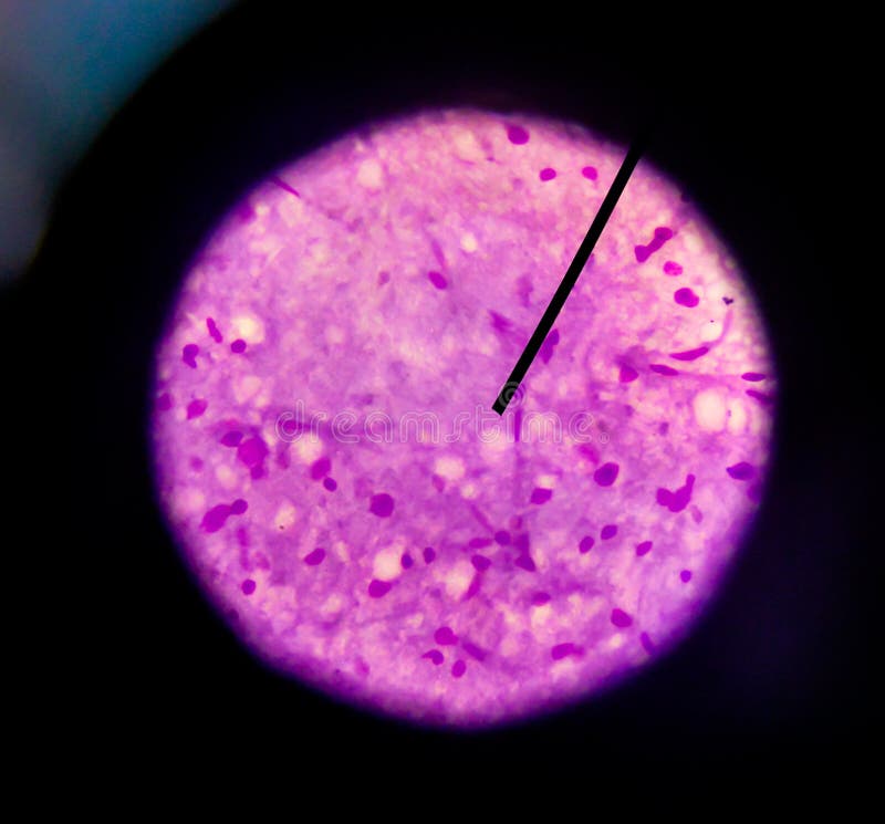 Cellules De Découverte Humaine Avec Le Microscope Photo stock - Image ...