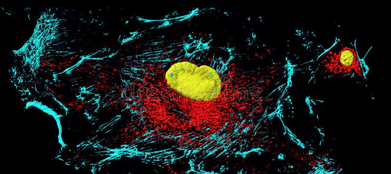 Cellules de fibroblaste image stock. Image du biologie - 32807495