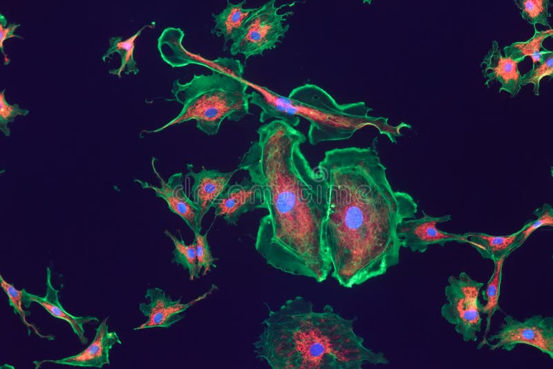 Cellules de fibroblaste image stock. Image du noyau, fibroblaste - 47622229