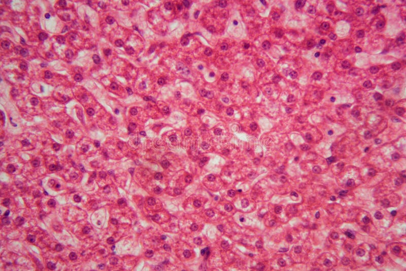 Hépatique Sous Microscope Cirrhose – AFEF