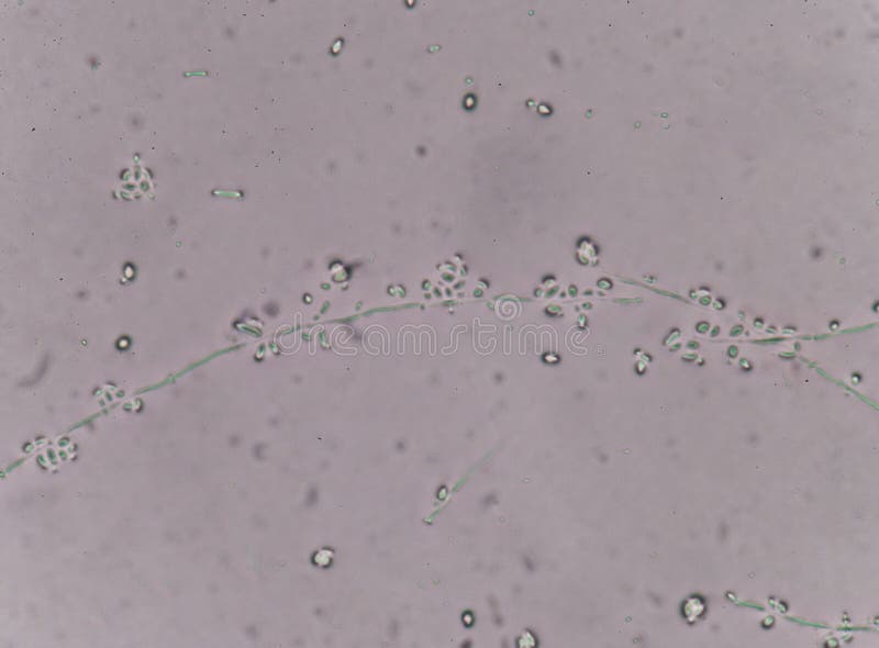 Cellules De Levure Dans Les échantillons D'urine Photo stock - Image du ...