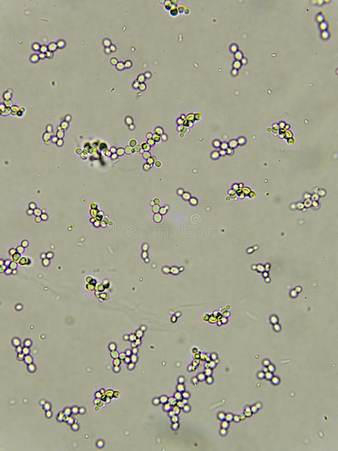 Les Cellules De Levure De Bourgeonnement Avec Des Pseudohyphae De ...