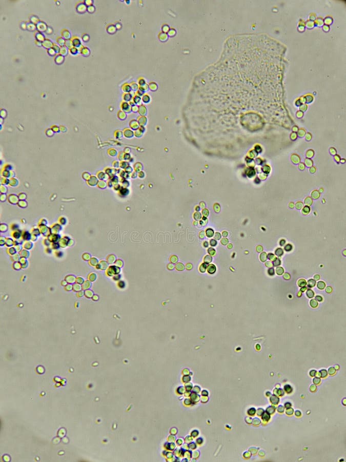 Les Cellules De Levure De Bourgeonnement Avec Des Pseudohyphae De ...