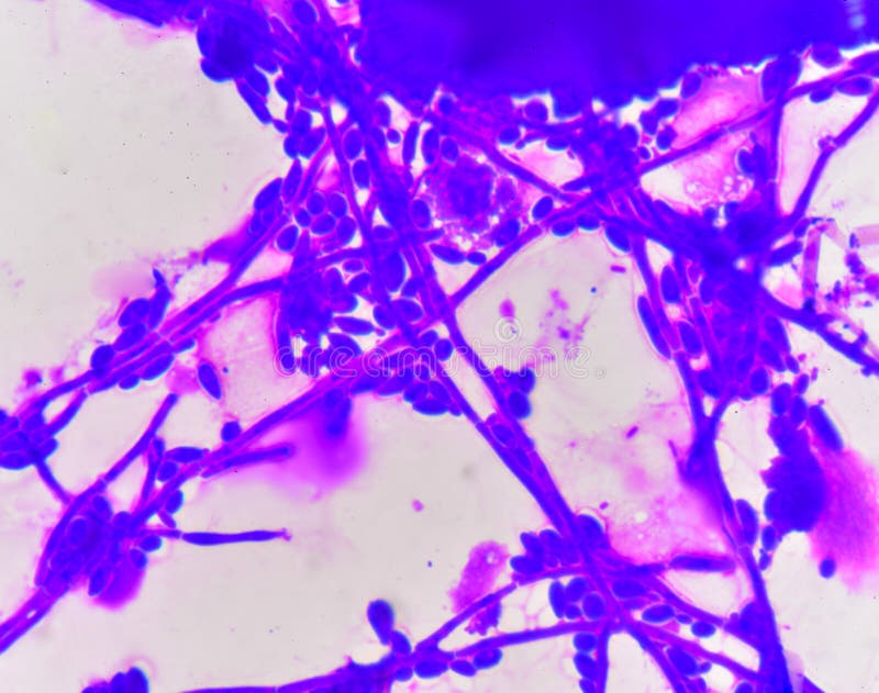 Cellules De Levure De Bourgeonnement Avec Des Pseudohyphae Image stock ...