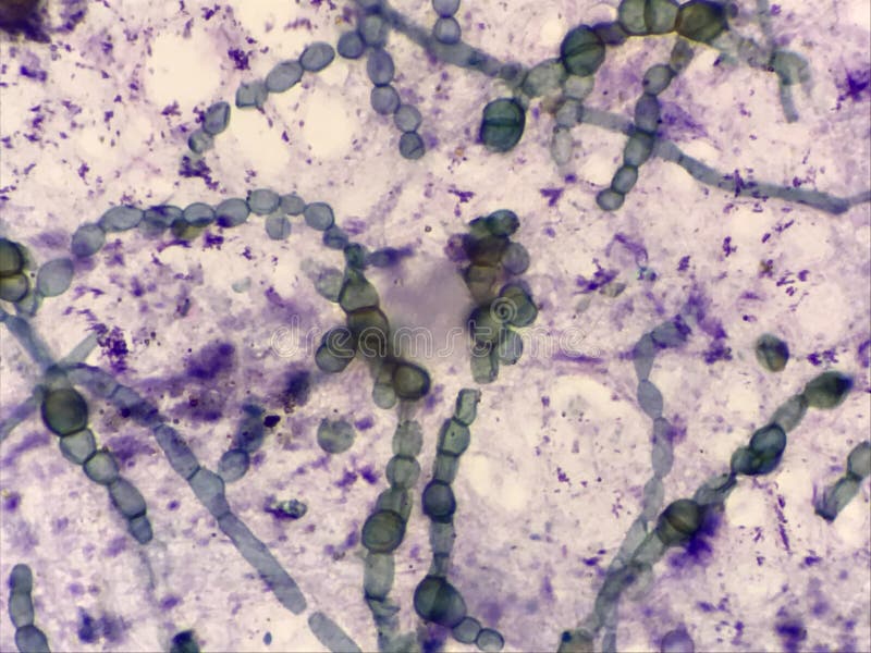 Cellules De Levure De Bourgeonnement Photo stock - Image of mycètes ...