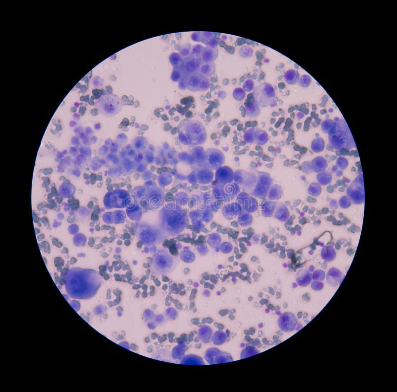 Cellules de Mesothelial image stock. Image du dermatologie - 67926061